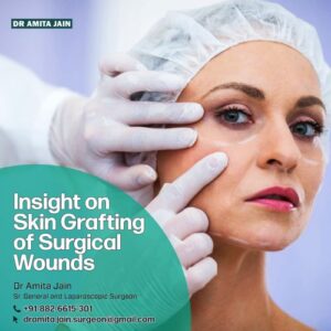 Insight on Skin Grafting of Surgical Wounds - Dr Amita Jain