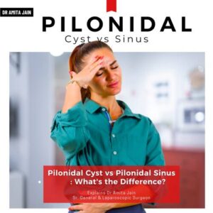 Pilonidal Cyst vs Pilonidal Sinus: How Do They Differ?