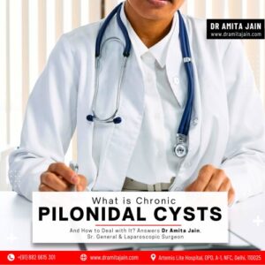 What is a Chronic Pilonidal Cyst and How to Deal with It?